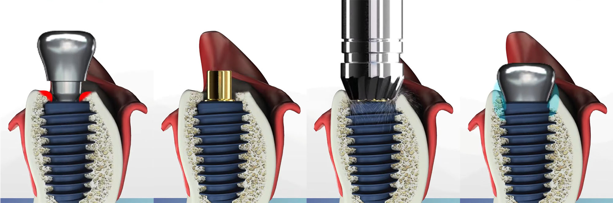 Megagen - Megagen site